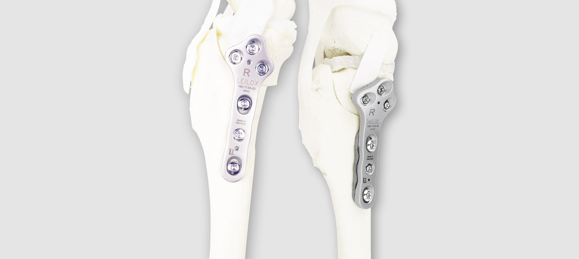 TPLO Stainless Steel – Veterinary.Shop