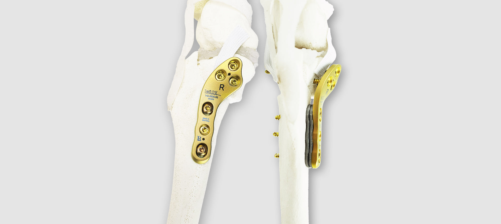 TPLO Swing Titanium – Veterinary.Shop